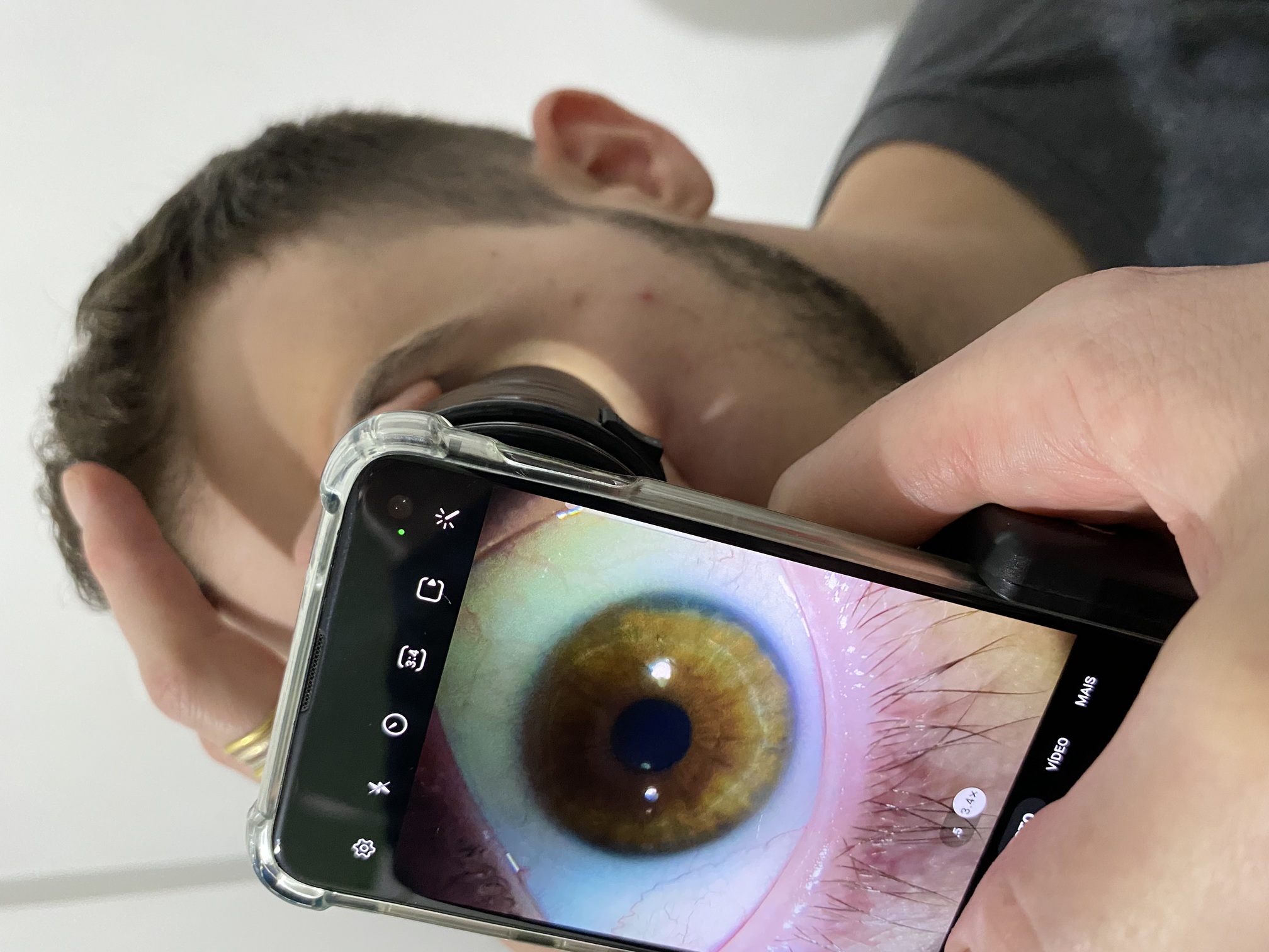 SMART-IRIS | Iridophoto