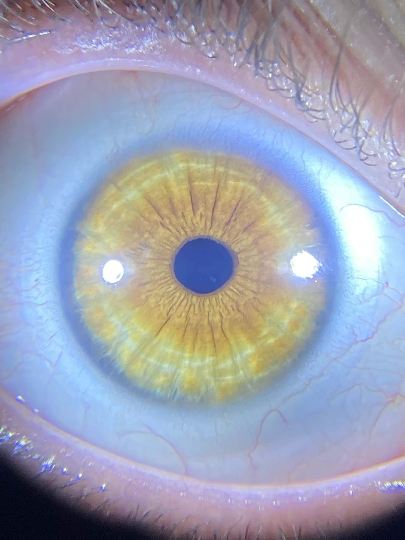 SMART-IRIS | Iridophoto