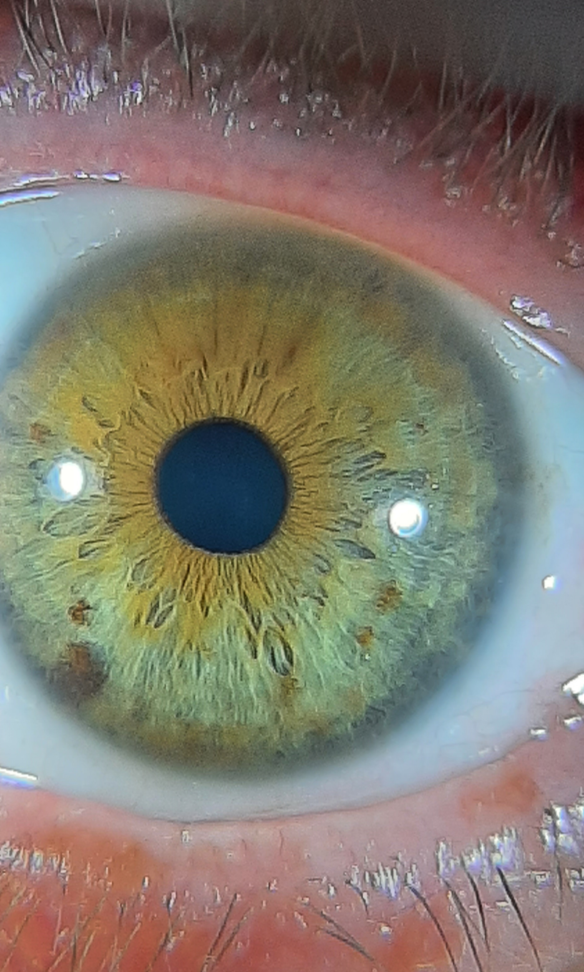 SMART-IRIS | Iridophoto